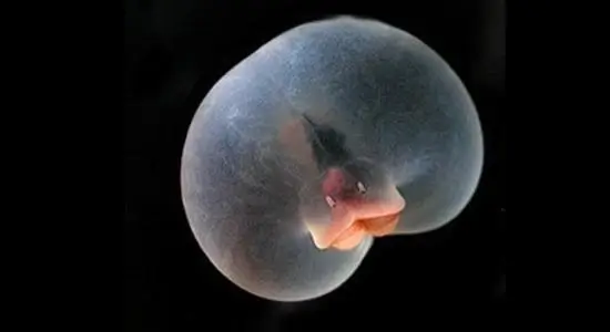 Pigbutt worm, a sea worm that looks more like a pig's butt than a worm ...